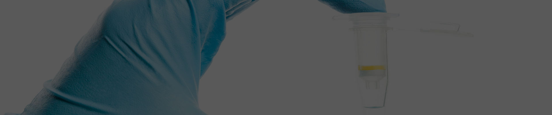 Choosing Spin Columns for DNA Extraction | MP Biomedicals